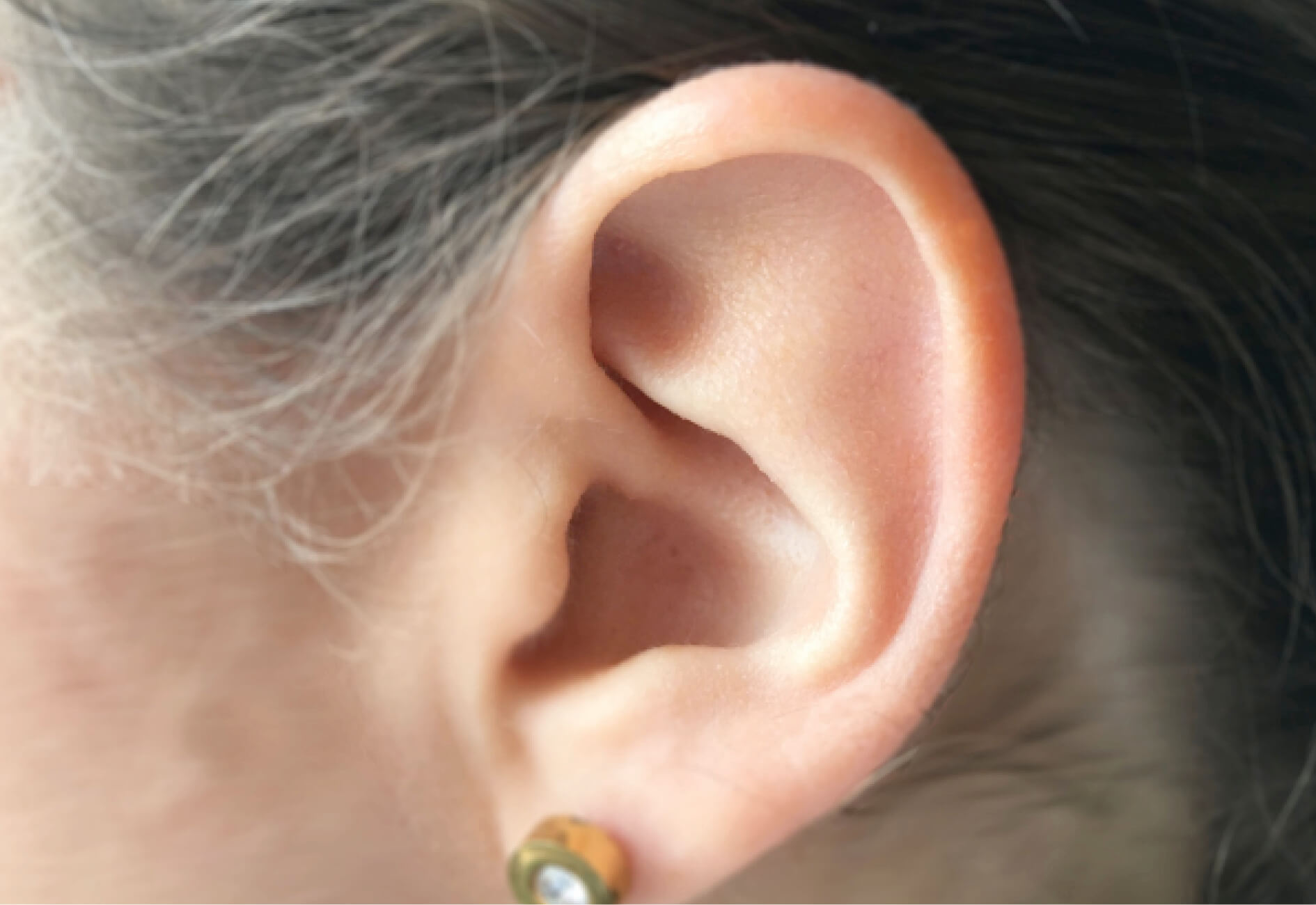 Naturheilkunde gegen Ohrenschmerzen & Tinnitus?
